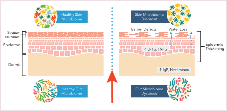 Exploring The Link Between Skin And Gut Health: Insights From Science